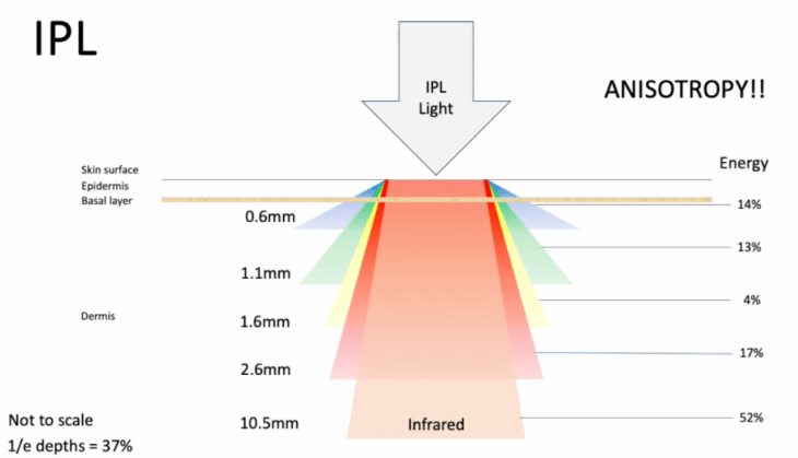Comparing laser light with IPL light energy in the skin – Mike Murphy's ...